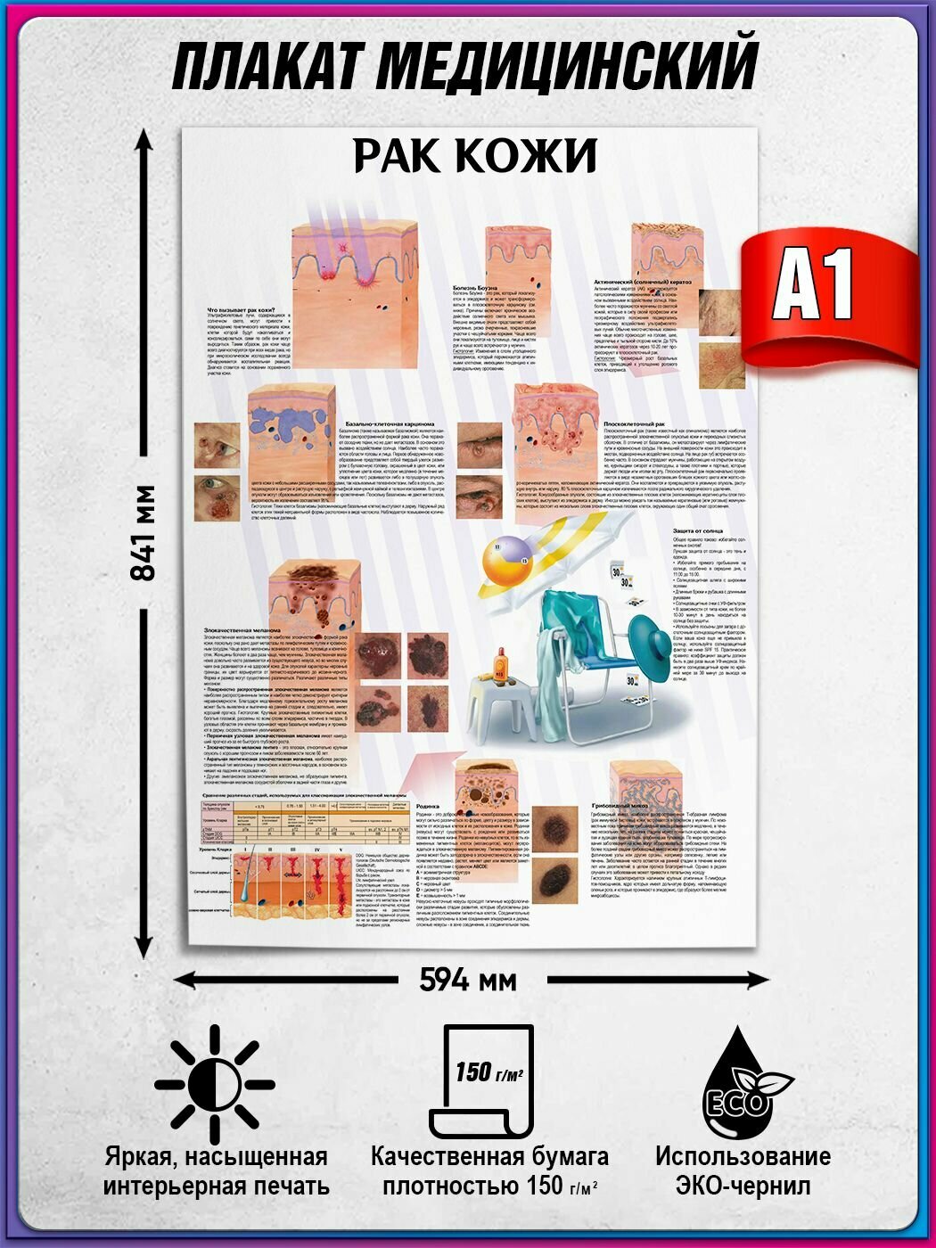 Информационный медицинский плакат "Рак кожи" / Формат А1 (60х84 см.)