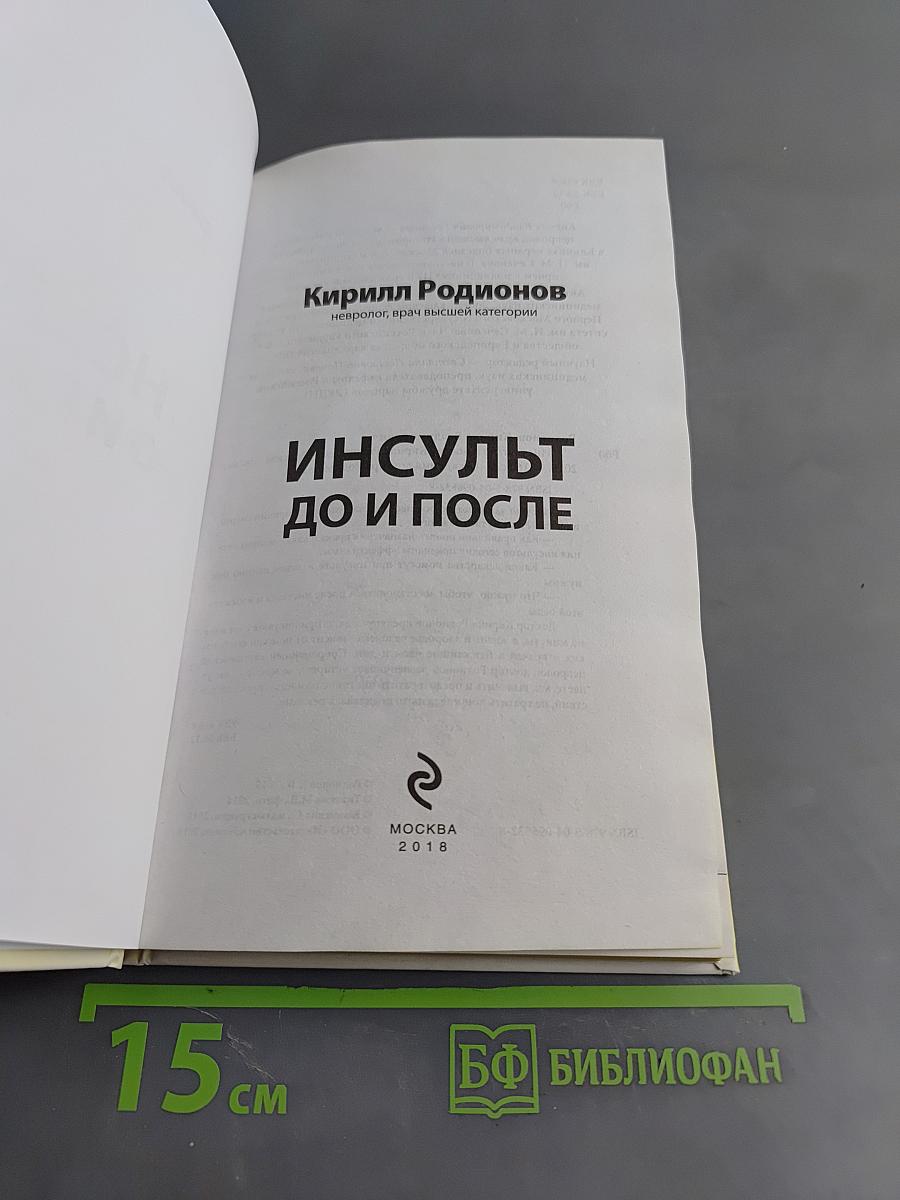 Инсульт до и после — фото 1
