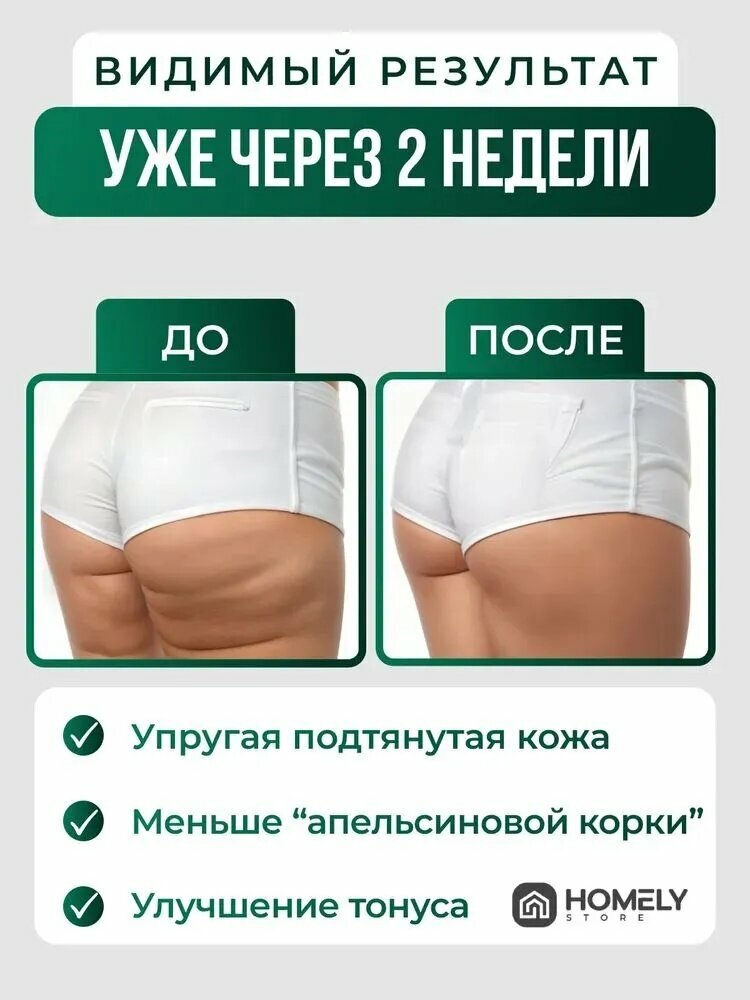 Вакуумный массажер антицеллюлитный для тела / массажер от целлюлита