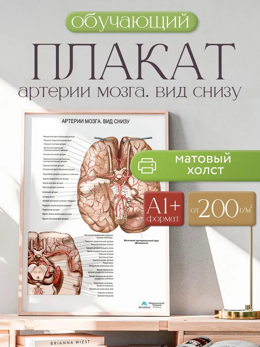Артерии мозга. Вид снизу плакат, матовый холст от 200 г/кв. м, размер A1+