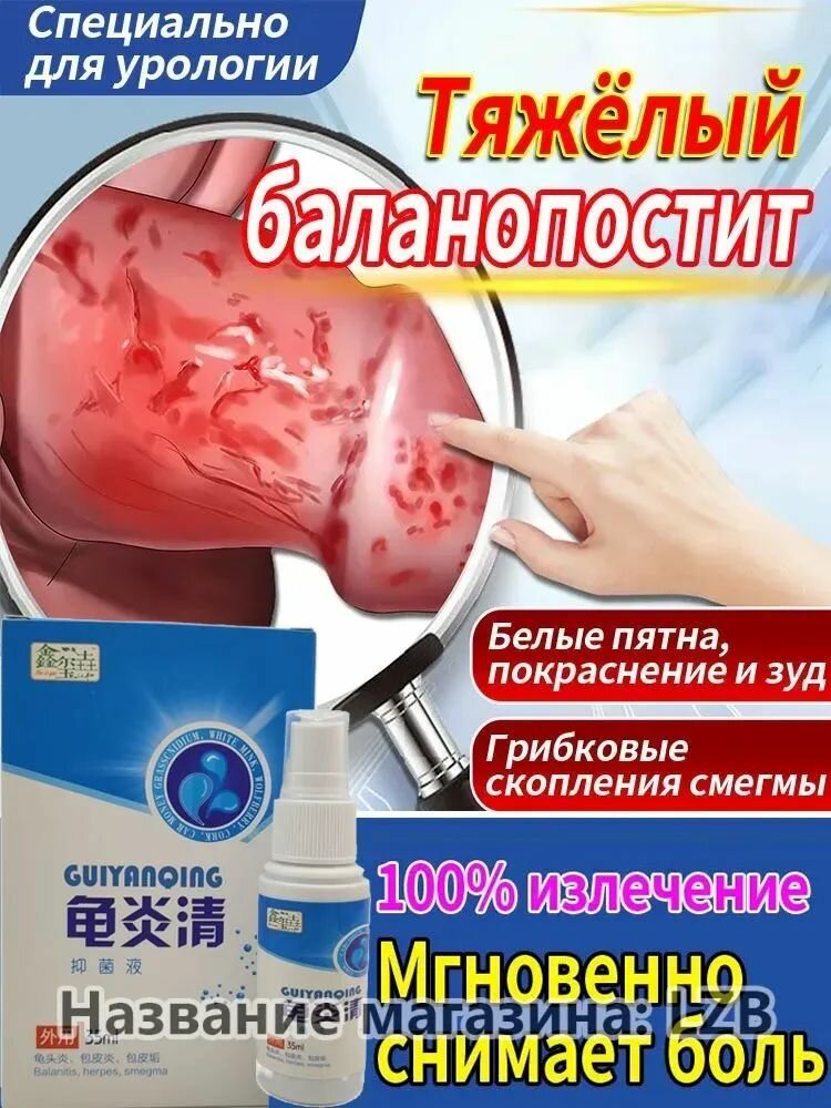 Спрей для мужчин при баланопостите, 35 мл, быстрое облегчение зуда, жжения и покраснения в интимной зоне спрей от баланопостита интимный спрей от зуда и жжения