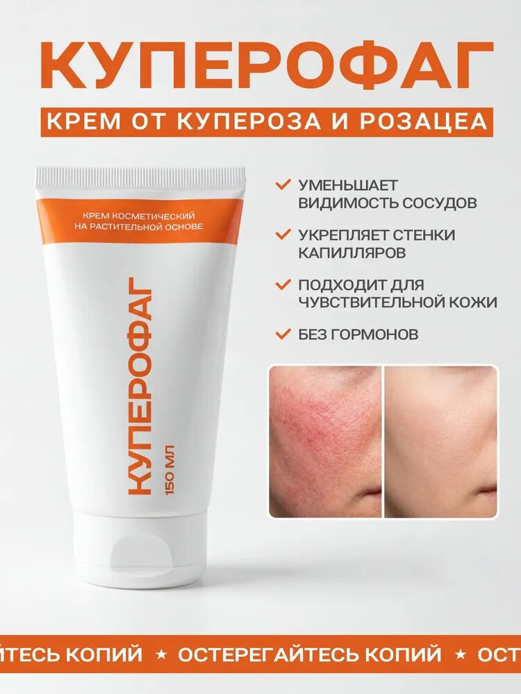 Куперофаг Крем от купероза на лице, антикупероз, средство от сосудистых звездочек, от покраснений, розацеа, успокаивающий увлажняющий крем для лица с мочевиной витамин С Е, пантенол