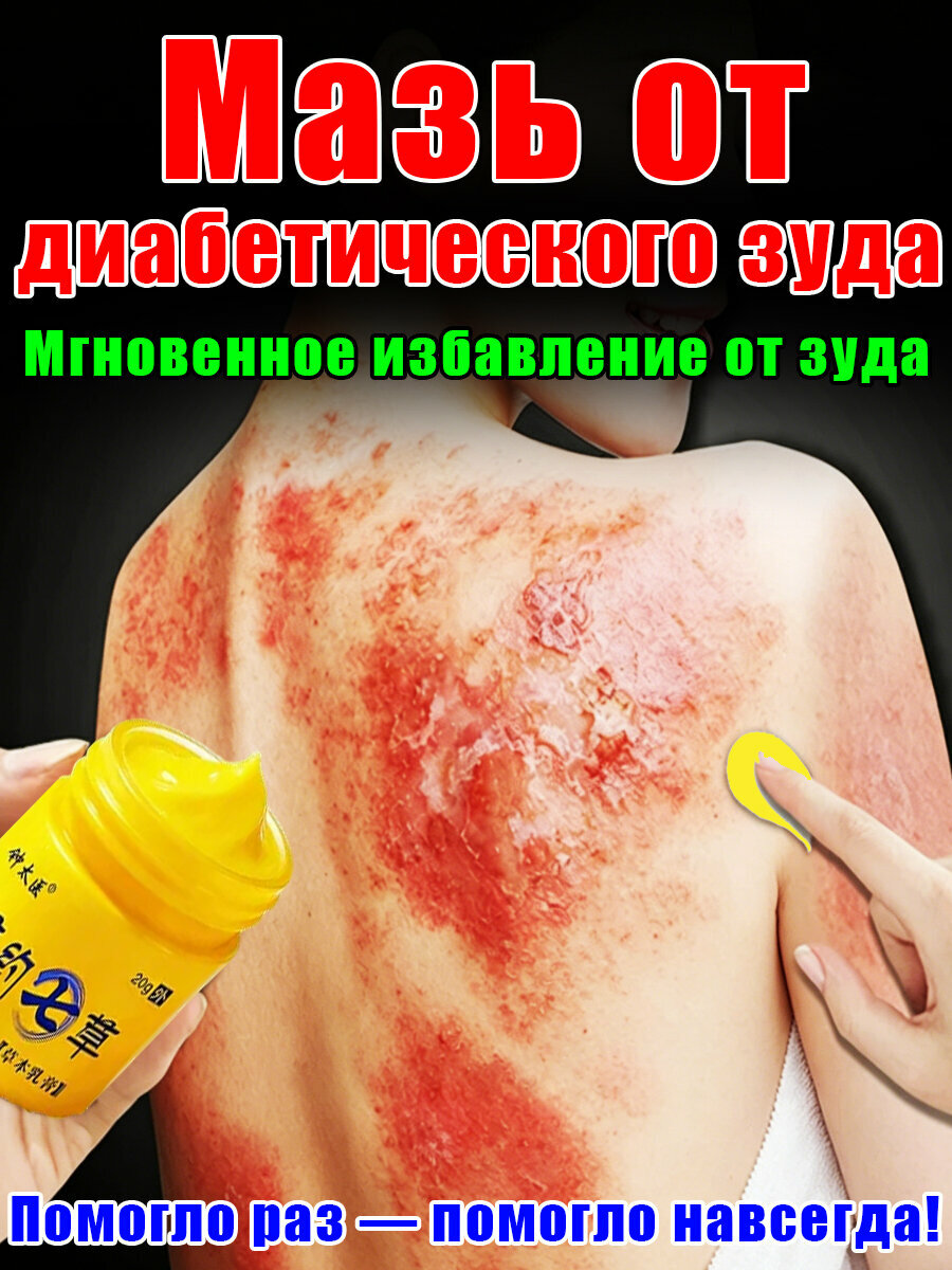Мазь от кожного зуда при диабете быстрое облегчение