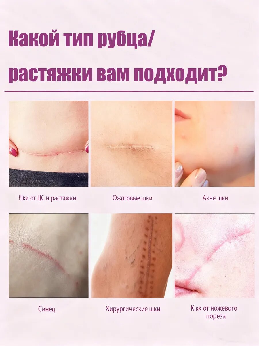 Крем для ухода за кожей — фото 1