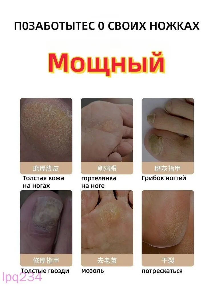Терка педикюрная — фото 1