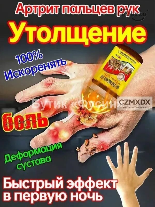 Мазь от подагры, Устранение боли при артрите, коленях, пальцах ног и т. д, на ноге для рук артрита 55 г
