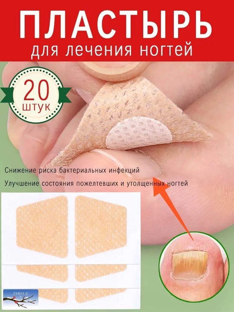 Пластырь для лечения ногтей для борьбы с грибком, коррекции ногтей, набор 20шт.