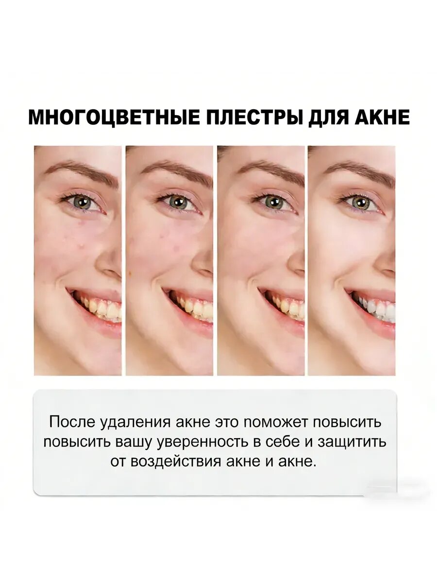 Патчи от прыщей — фото 1