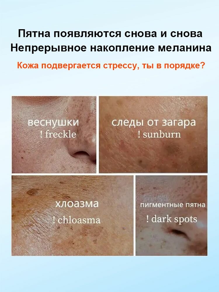 Осветляющая сыворотка для лица с арбутином и ниацинамидом, Двойной против пигментации, против веснушек и пигментных пятен, , омолаживающий, увлажняющий, 30г