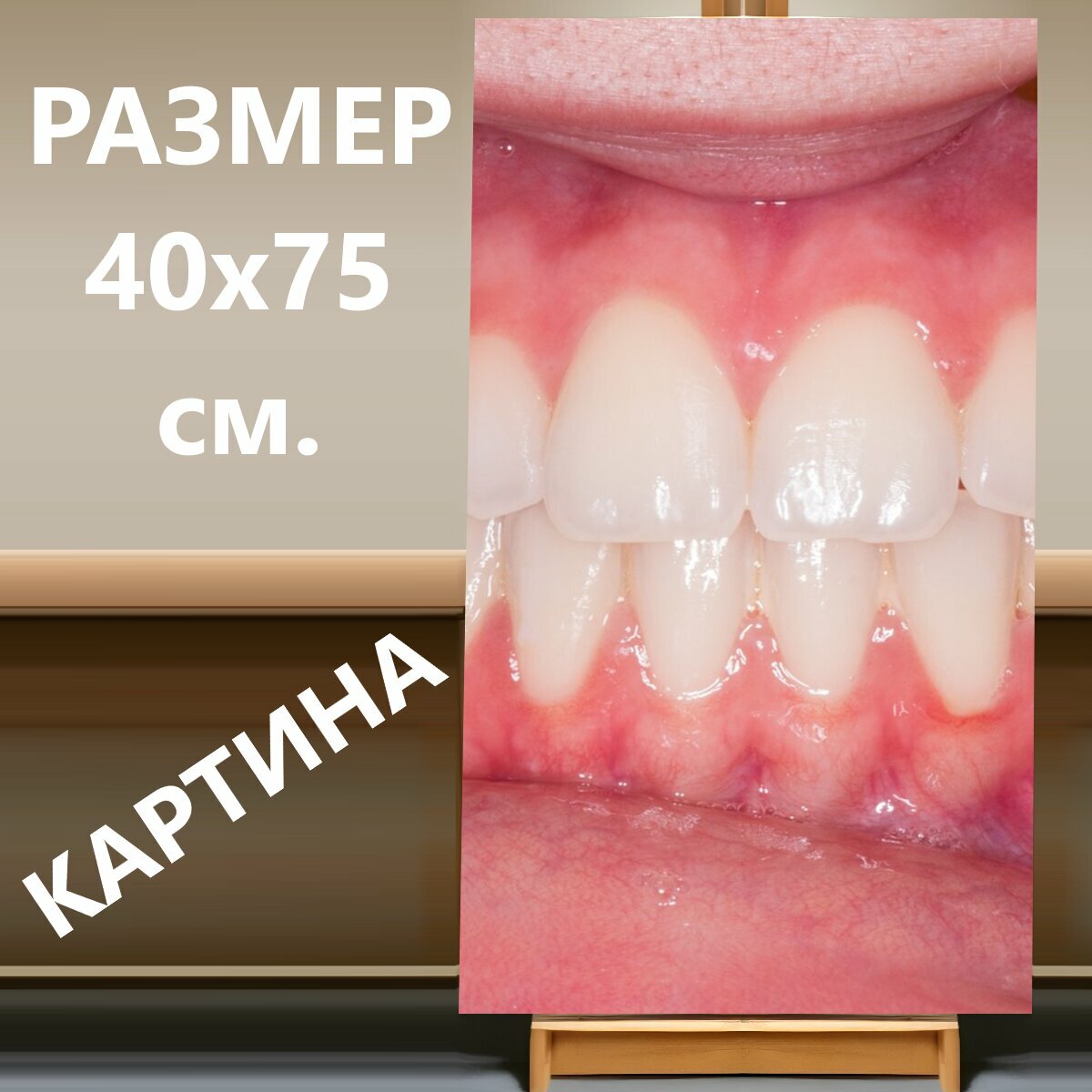 Картина на холсте "Зубы, улыбка, дантист" на подрамнике 75х40 см. для интерьера
