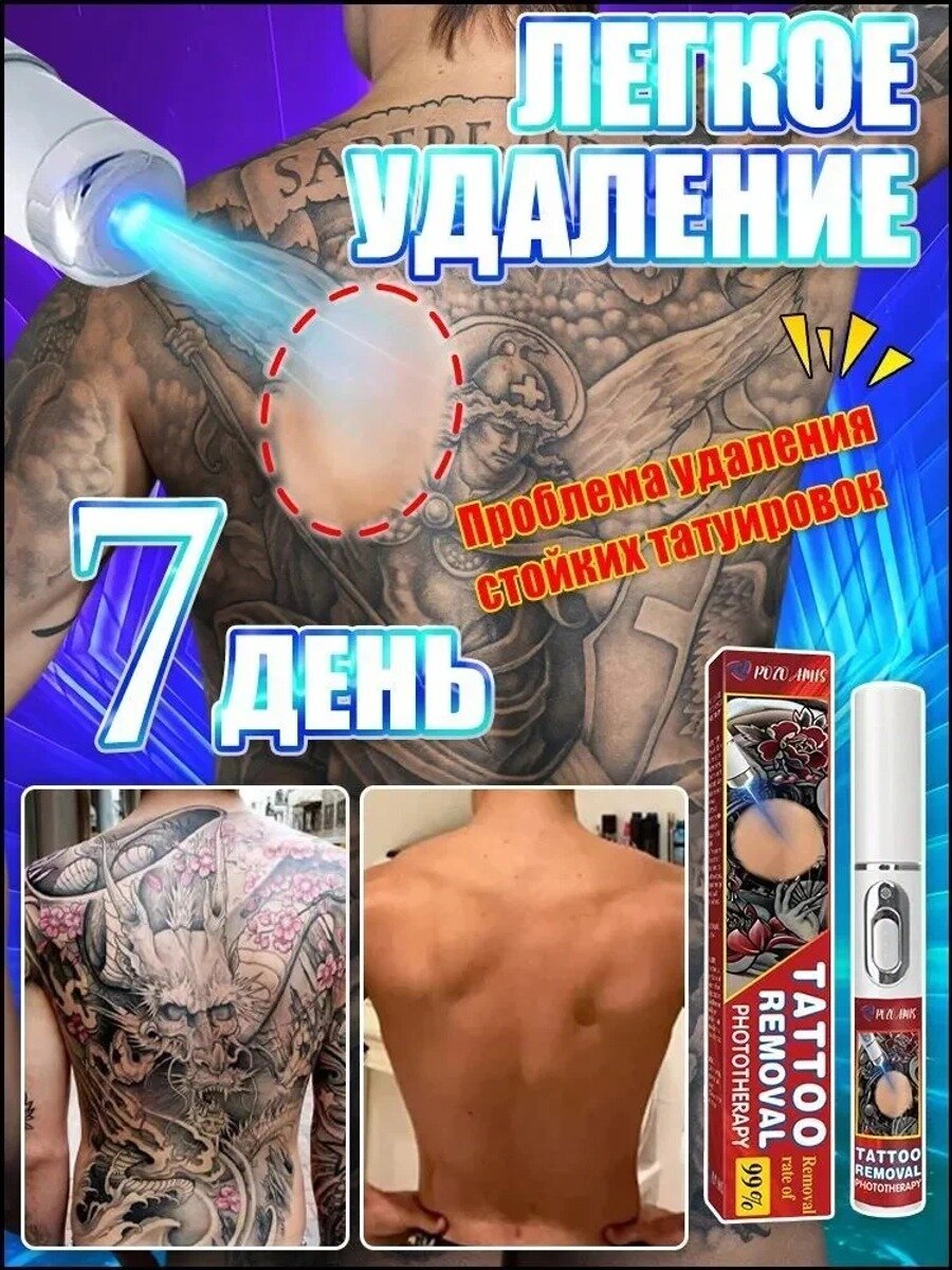 Лазерная ручка для удаления татуировок, постоянное удаление татуировок, быстрая и эффективная глубокая очистка, безболезненно, без побочных эффектов и без шрамов,1PC