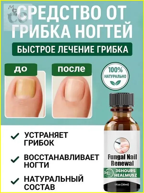 Китайское средство от грибка ногтей 30 мл лечение и профилактика онихомикоза