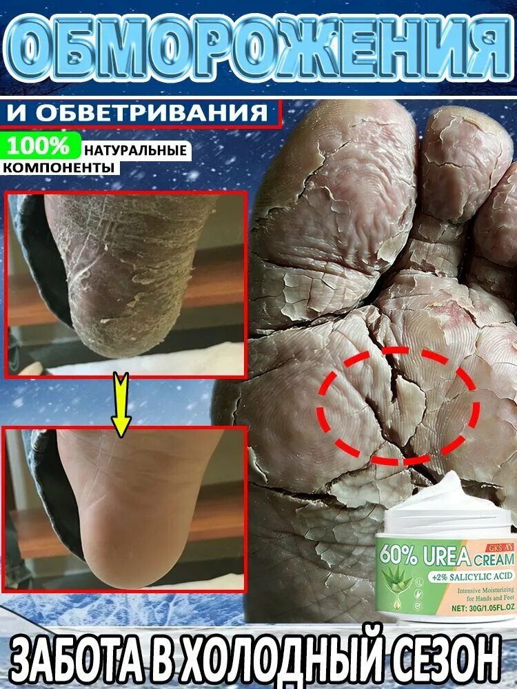 Этот увлажняющий крем для рук и ног быстро питает сухую кожу, смягчает кутикулу, улучшает состояние заусенцев, осветляет тусклую кожу и подходит для заживления трещин на руках, ногах и теле 30 мл