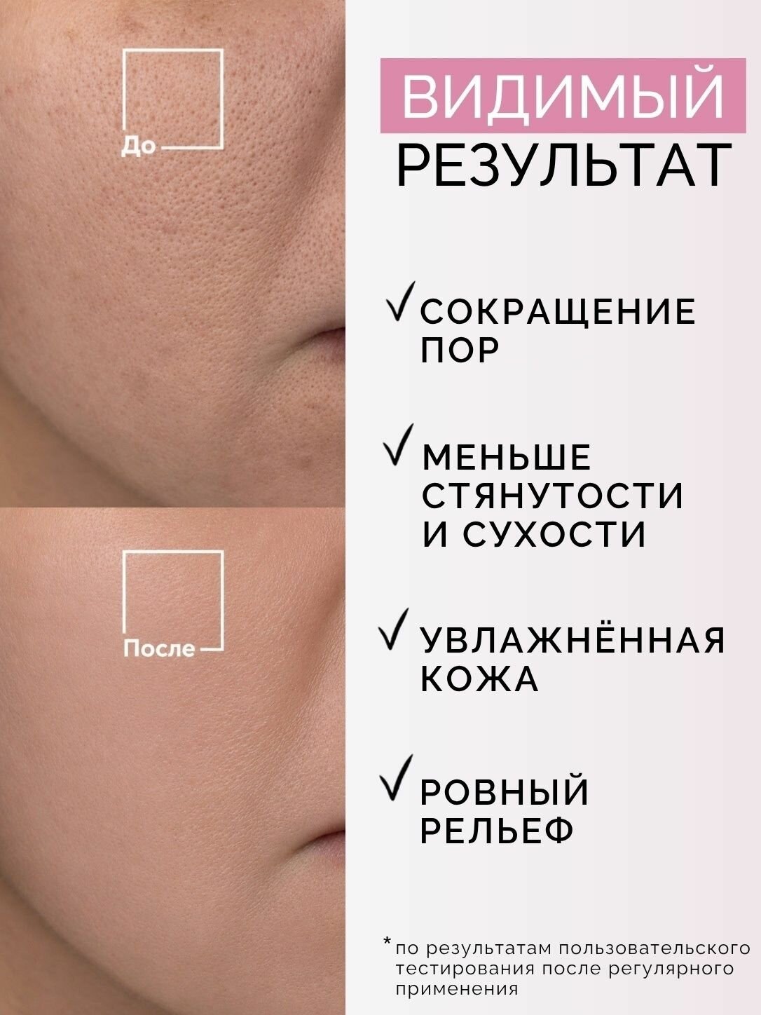 Skin1004 Увлажняющий крем-гель для сужения пор с центеллой Madagascar Centella Poremizing Light Gel Cream, 75 мл
