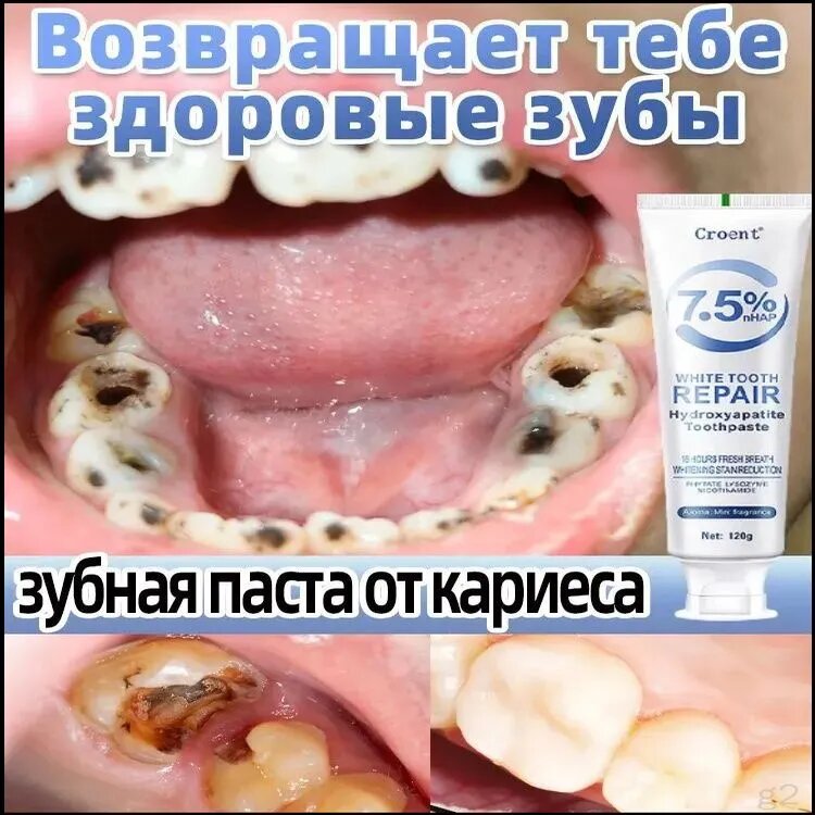 Зубная паста 7,5% гидроксиапатита восстановление эмали предотвращение кариеса