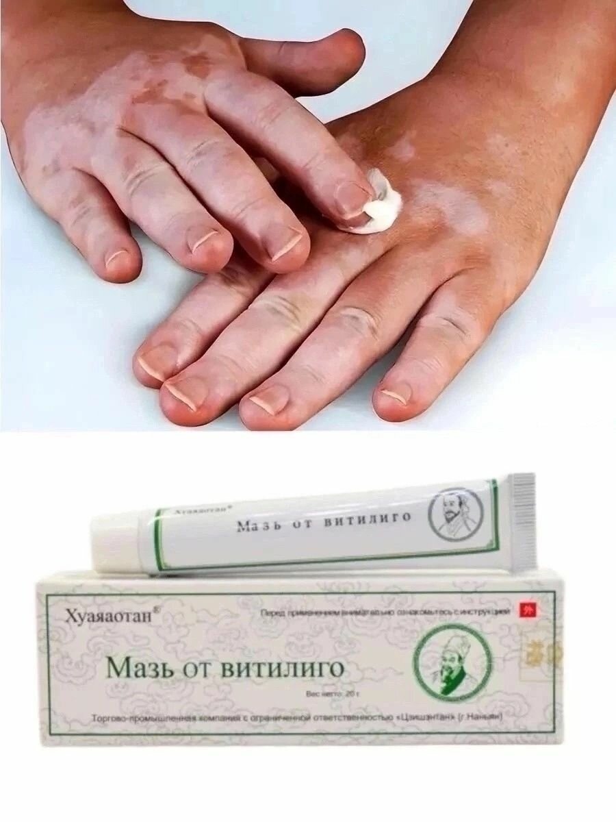 Мазь от витилиго — фото 1