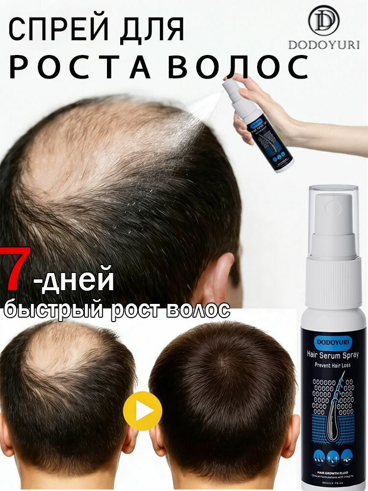 DODOYURI Спрей для роста волос 30 мл Стимулирует рост, укрепляет волосы и предотвращает их выпадение
