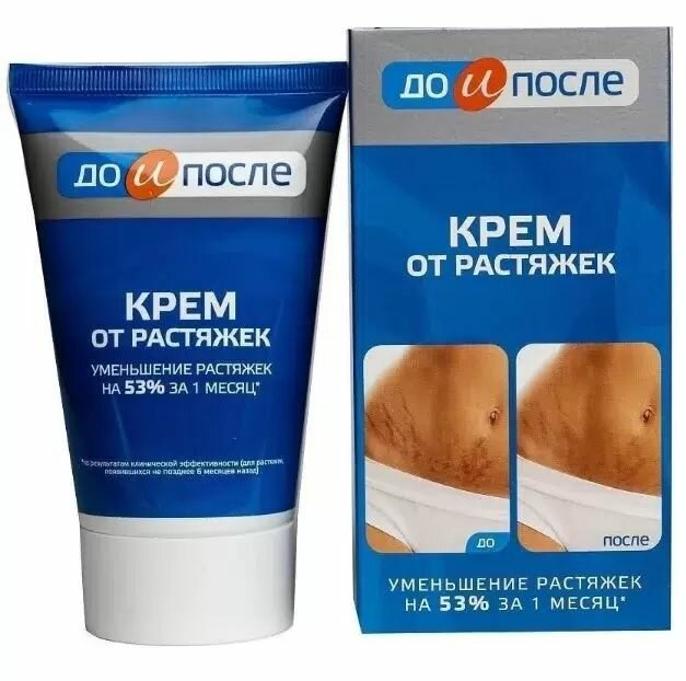 Крем от растяжек, 100 мл, "До и После"