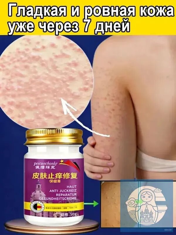 Крем для тела от гусиной кожи и сухости 50ml