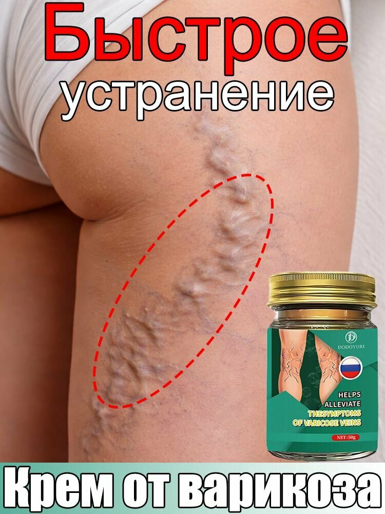Крем от варикоза с быстрым действием за 7 дней венотонизирующее средство, снимающее отёки и чувство тяжести в ногах. Эффективен при варикозном расширении вен и тромбообразовании. 50 мл