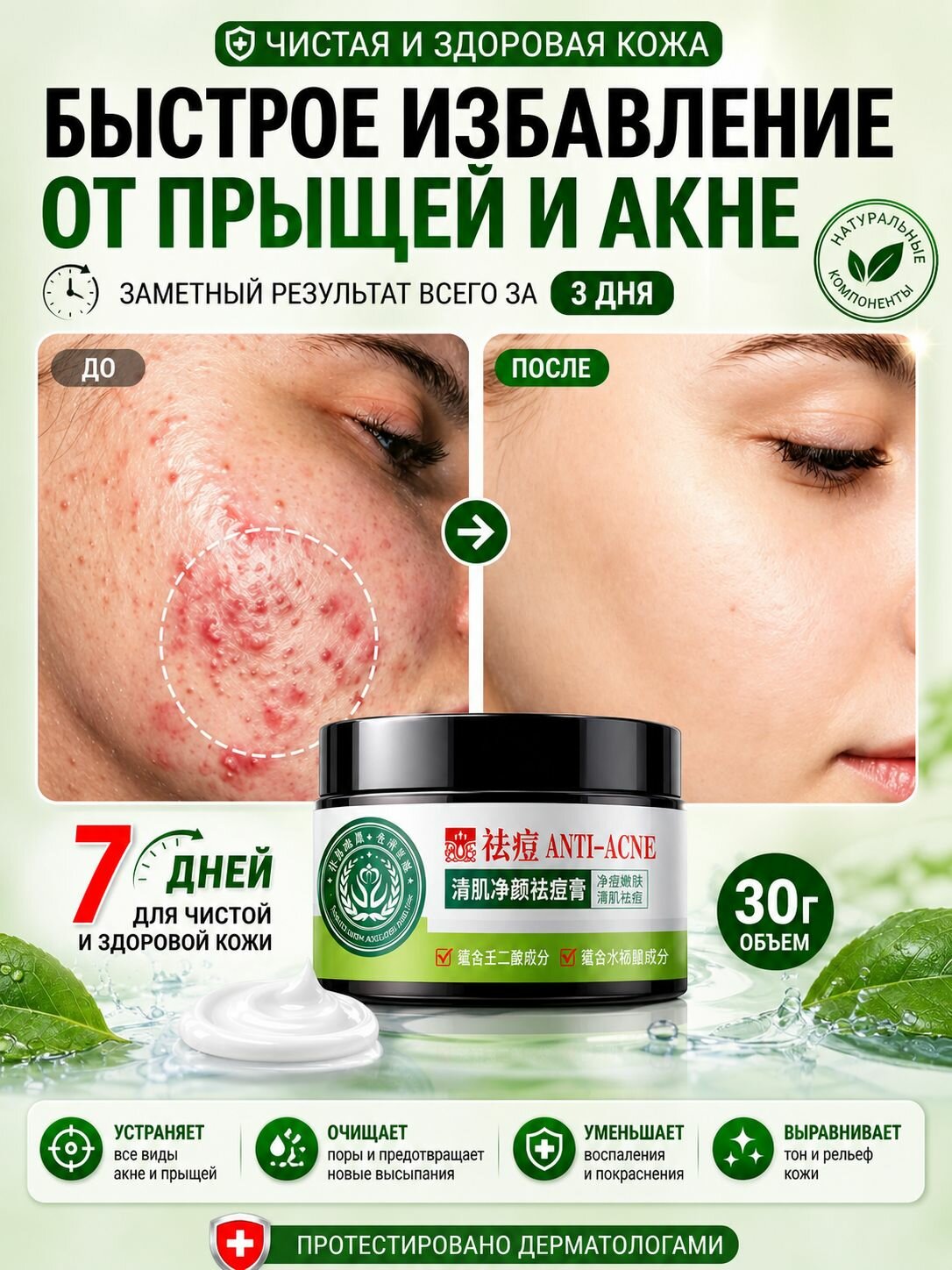 Салициловая мазь от прыщей и акне, 30 г, средство для проблемной кожи лица против воспалений, угрей и постакне