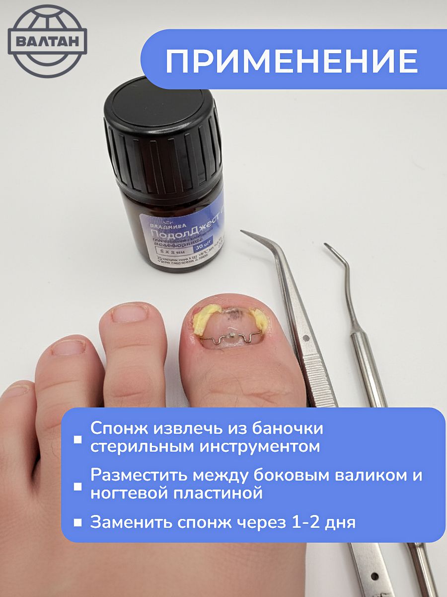 Спонжи для педикюра ПодолДжест антибактериальные, 31 мл, антибактериальные спонжи подолджест гемостатические губки