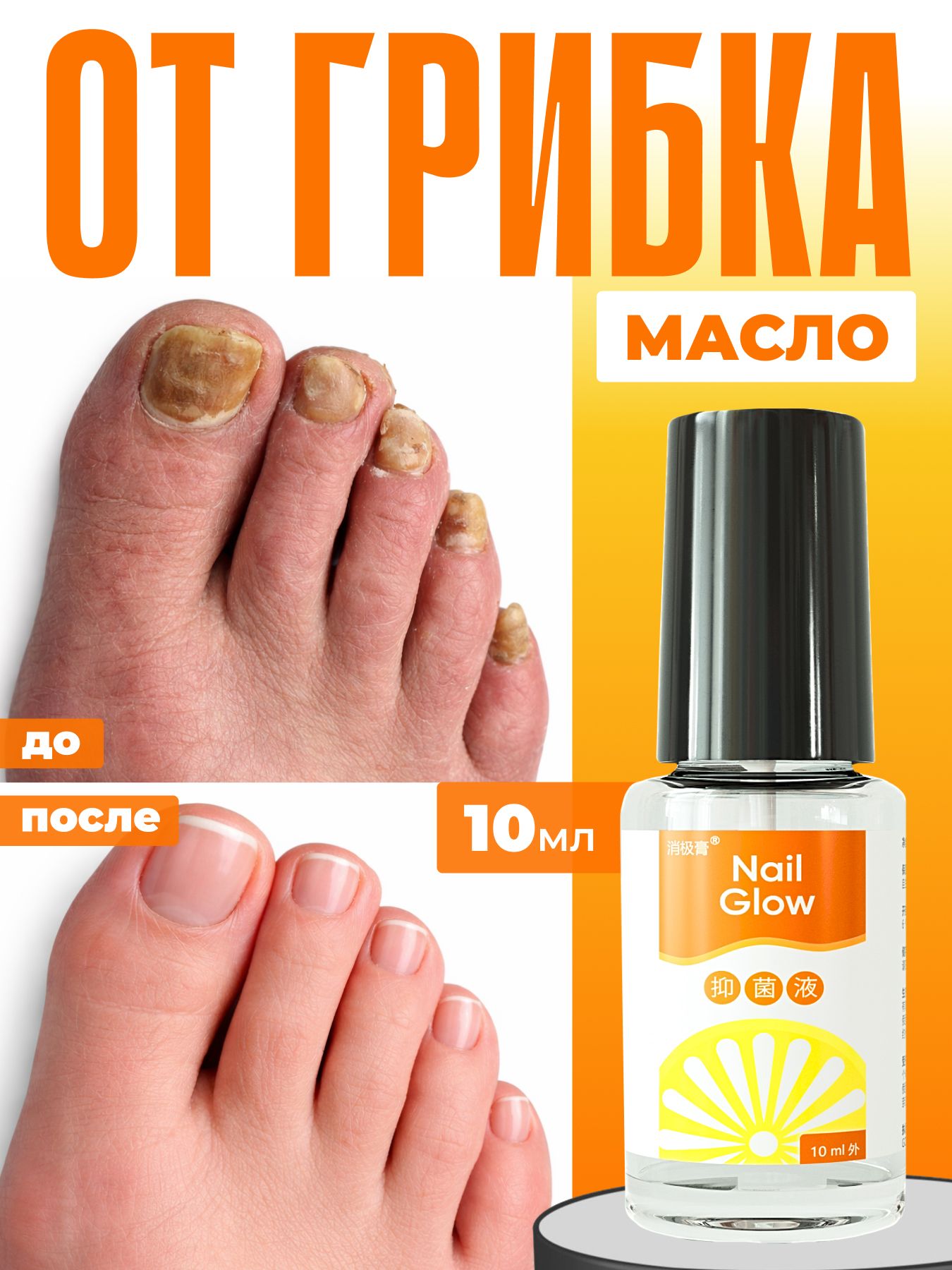 Масло для ногтей от грибка, средство для лечения грибка Nail Glow, 10 мл, лечение онихолизиса