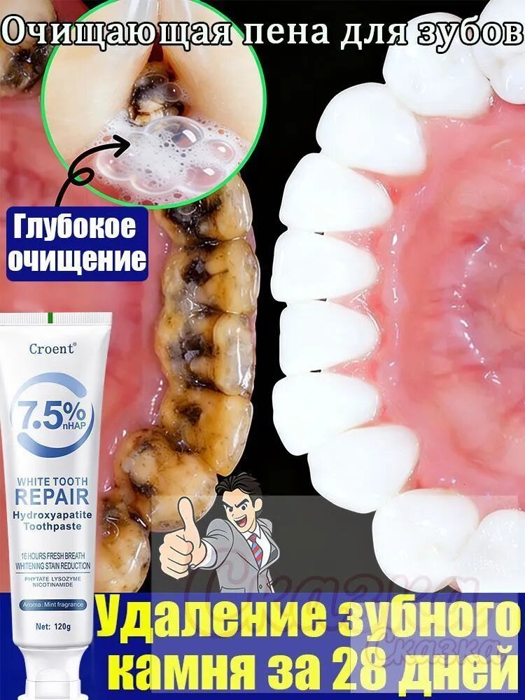 Мощная отбеливающая зубная паста, Удаление зубного камня , отбеливание желтых зубов, для чувствительных зубов, укрепление десен,120г