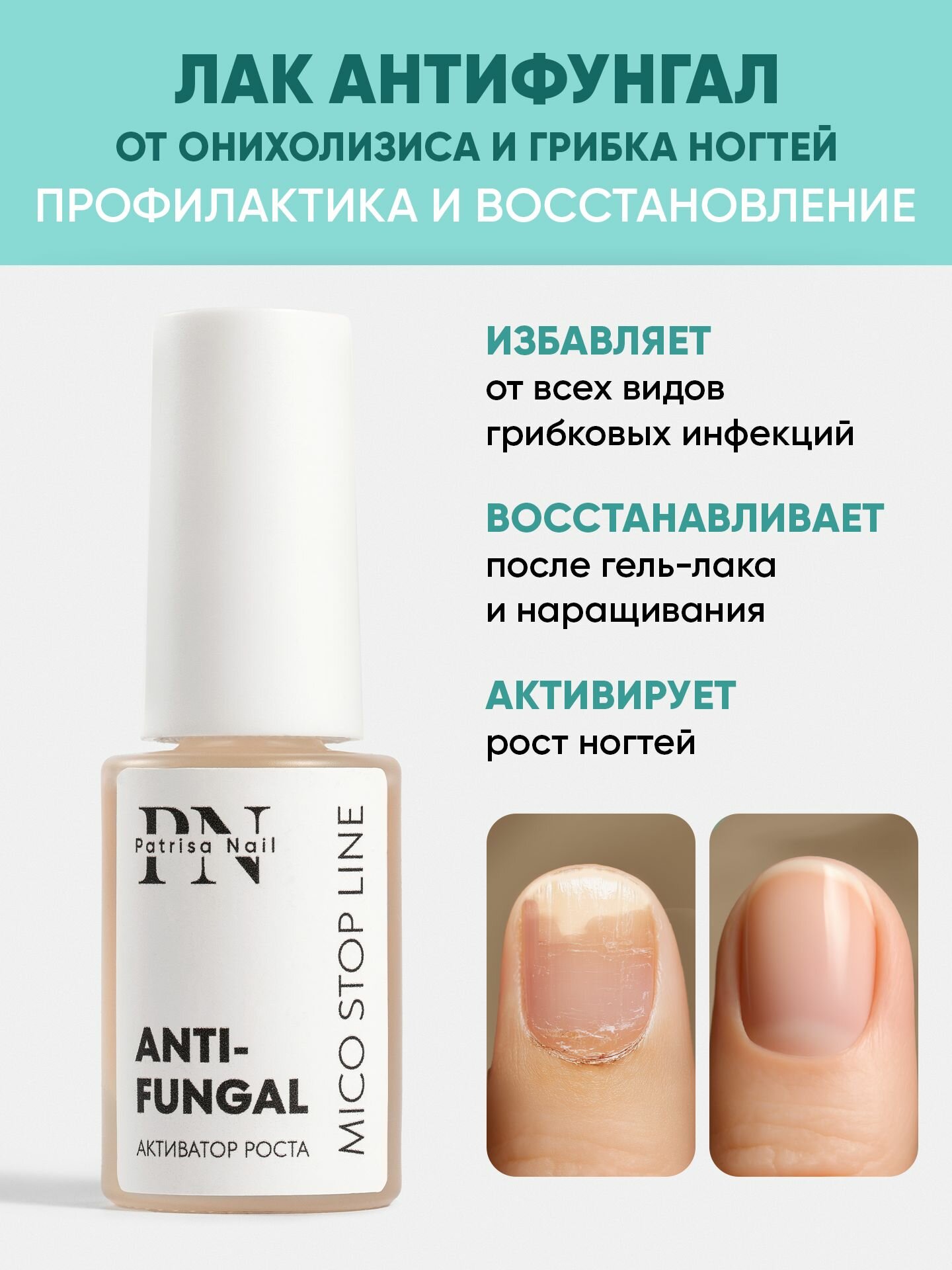 Лак Антифунгал - Активатор роста, средство для профилактики грибка ногтей и онихолизиса, 8 мл.