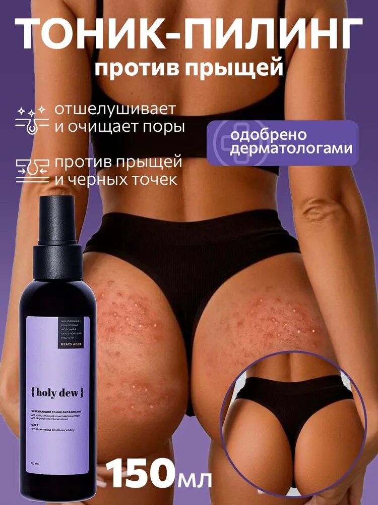 HOLY DEW Тоник для лица и тела с ниацинамидом от прыщей BEATS ACNE, 150 мл