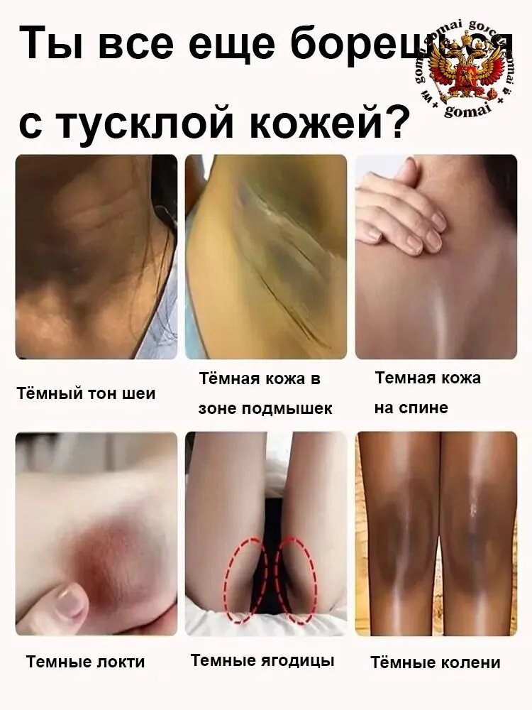 Твердое мыло — фото 1
