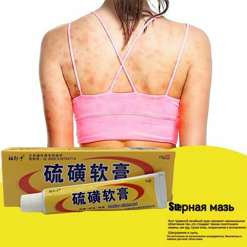 Мазь крем от псориаза, экземы, дерматита, лишая, прыщей, акне, 20 г / Мазь от псориаза китайская / Крем антибактериальный для кожи