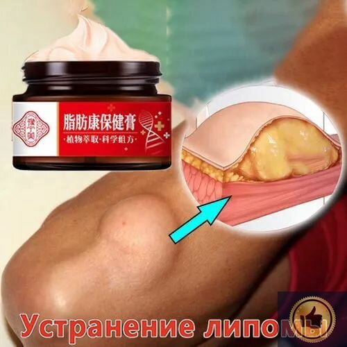 Мазь от липом и жировиков, быстро удаляет подкожные жировые опухоли, натуральный китайский, травяной крем для удаления целлюлита устранения, 30 г
