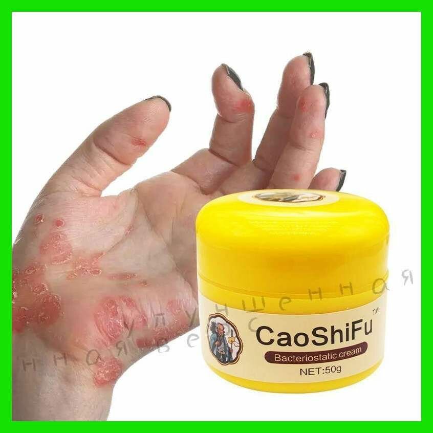 CAOSHIFU Антибактериальный крем для кожи, 50 г, большая емкость. Мазь от псориаза, дерматита, зуда кожи и экземы, для проблемной кожи на теле. новая версия