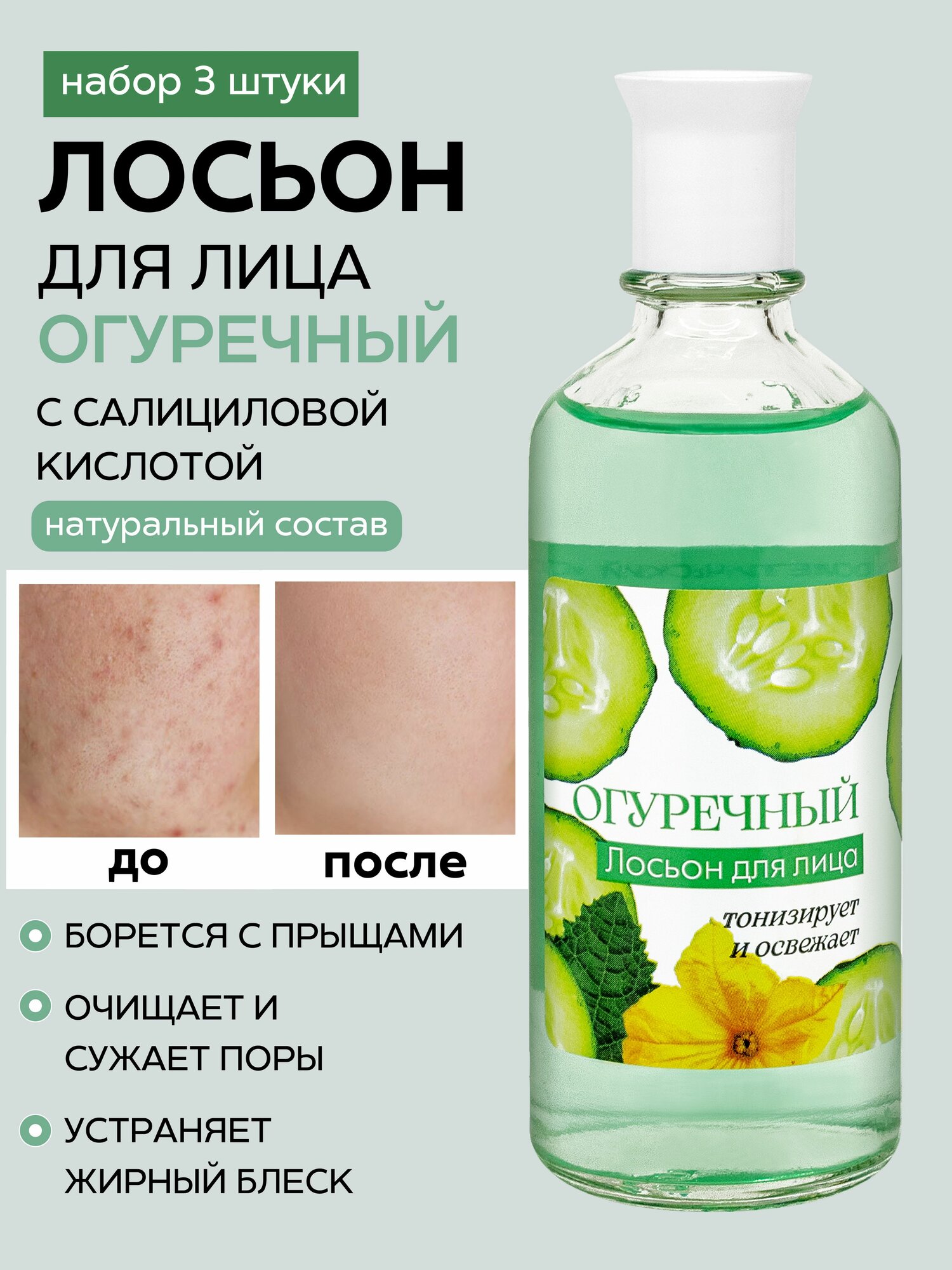 Лосьон для лица Огуречный от прыщей с салициловой кислотой 100мл *3шт