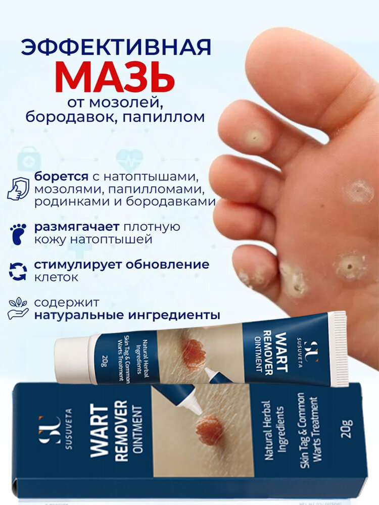SUSUVETA / Мазь от бородавок, Крем средство для удаления бородавок, папиллом и родинок, безболезненно, не оставляет следов без побочных эффектов / 20г