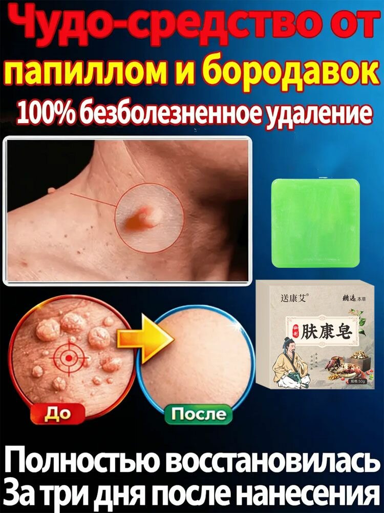 Клареол гель от папиллом / средство от бородавок, чистотел, мазь от сухих мозолей / INNOSKIN Klareol/
