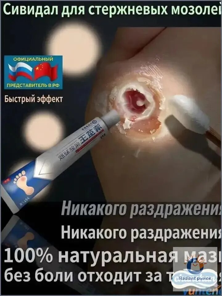 Средство от шипиц, натоптышей и сухих стержневых мозолей на ногах мазь и гель Корнекс, эффективное китайское средство