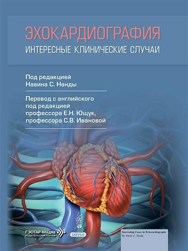 Эхокардиография. Интересные клинические случаи