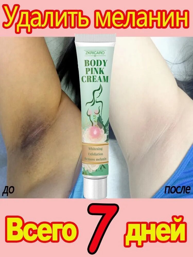 Отбеливающий крем подходит для интимных зон, тела, ягодиц, подмышек, коленей и локтей, удаляет пигментацию, пигментные пятна и уменьшает тусклость кожи, 60 мл