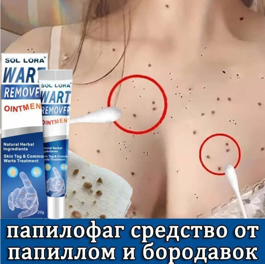 Мазь от папиллом и бородавок натуральное средство для удаления кожных наростов 20 г