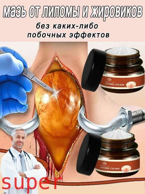 Волшебная мазь для быстрого лечения липомы