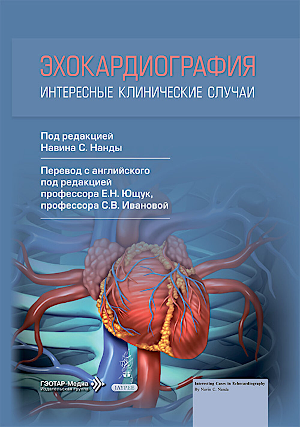 Эхокардиография. Интересные клинические случаи. Под ред. Нанды Н. С.