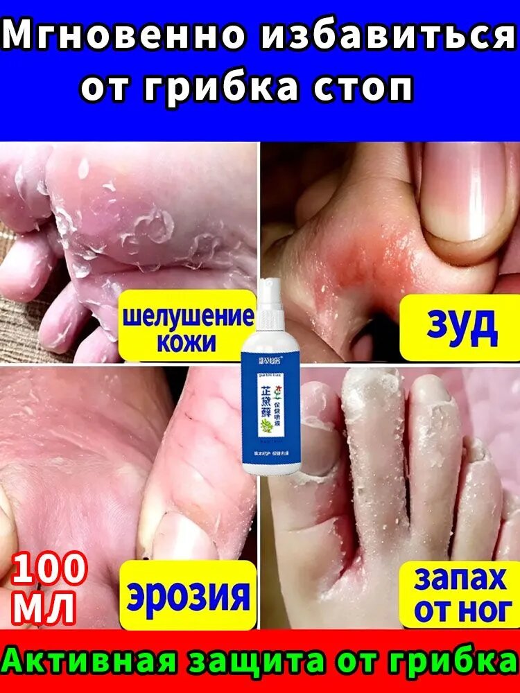 Мазь от грибка ногтей на ногах