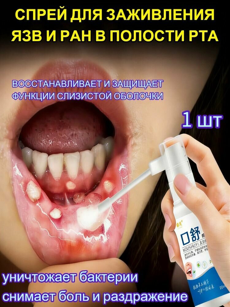 Спрей для заживления ран в полости рта Mouth Ulcer / Снимает боль и раздражение, Уничтожает бактерии, Восстанавливает функции слизистой оболочки 20 мл 20 мл для язв во рту антибактериальный восстанавливает слизистую