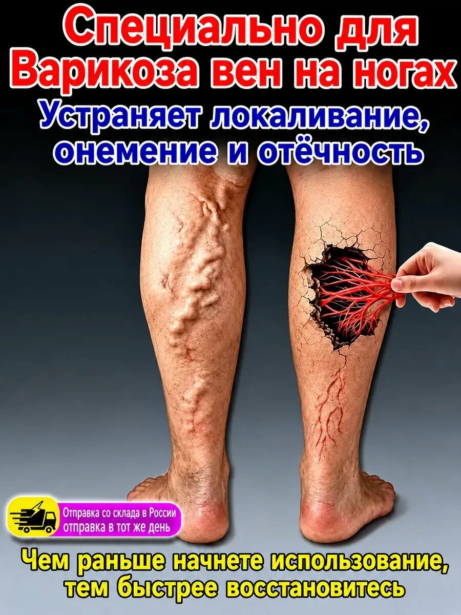 Флебофит мазь от варикоза алтай