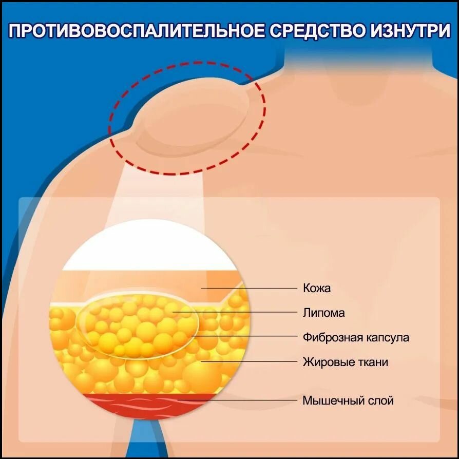 Лечебное средство "Дягиль", против опухолей, натуральный состав, 30 г — фото 1