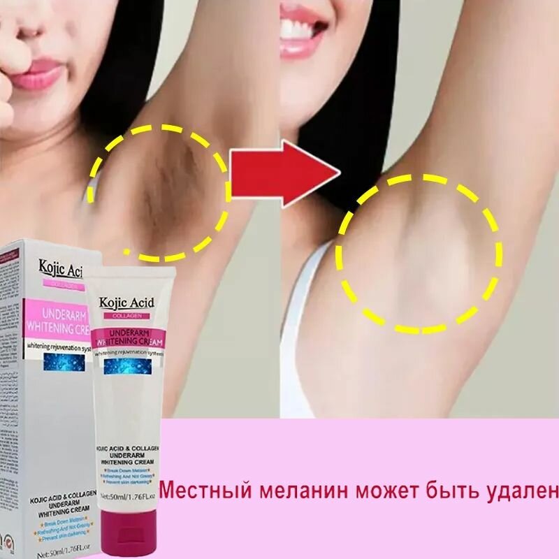 Осветляющий крем для тела, отбеливающий крем для подмышек, отбеливающий крем для интимной зоны, для зоны бикини, против пигментации, омолаживающий /увлажняющий 50 г