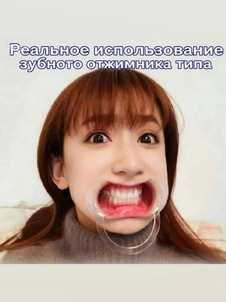 Расширитель для рта детский, стоматологический, 3 шт, универсальный