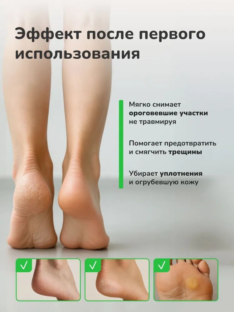 Пемза для ног нано терка для пяток, Нано покрытие, салонный результат в домашних условиях. — фото 1